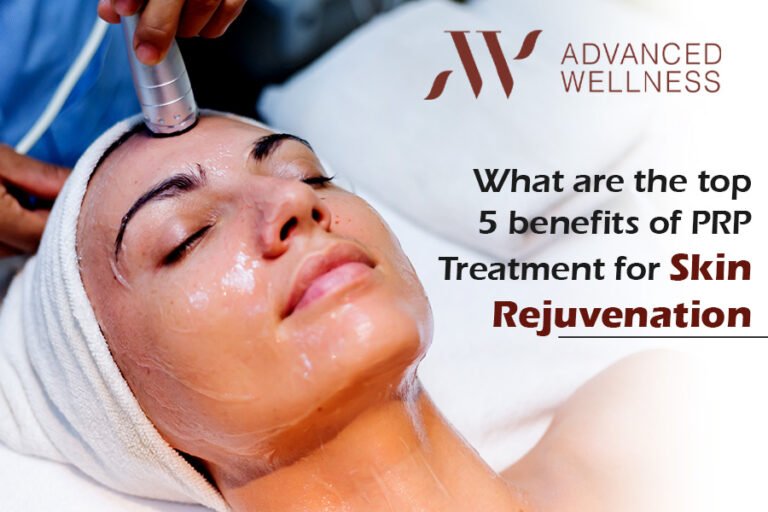 What Are The Top 5 Benefits Of PRP Treatment For Skin Rejuvenation ...